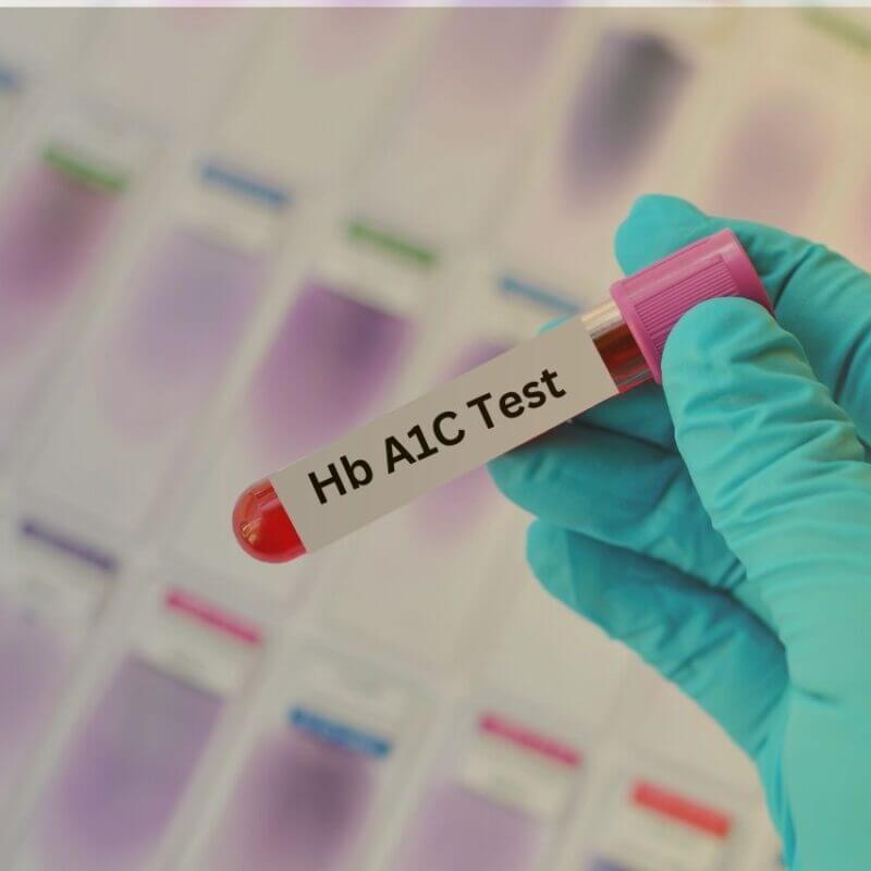 The Ultimate Guide to HbA1c Hemoglobin Testing and Results – Mughal Labs