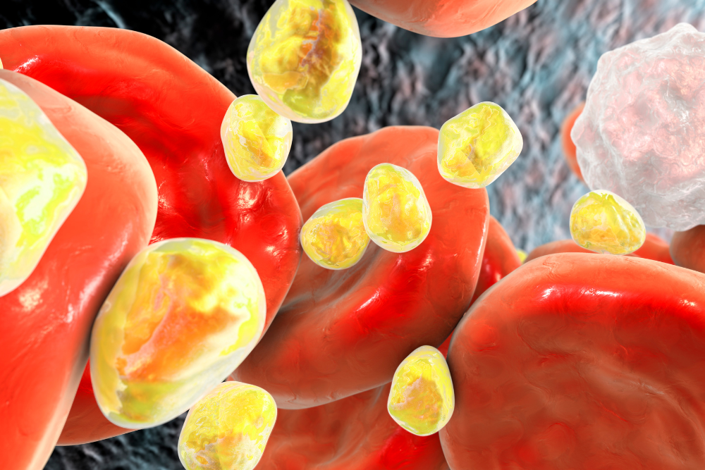 Lipid Profile Test Report: Understand Your Cholesterol Levels